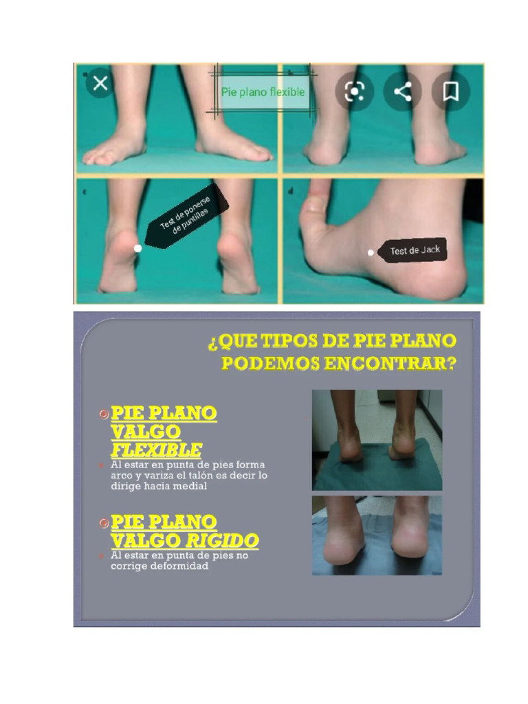 Pie Plano | PDF