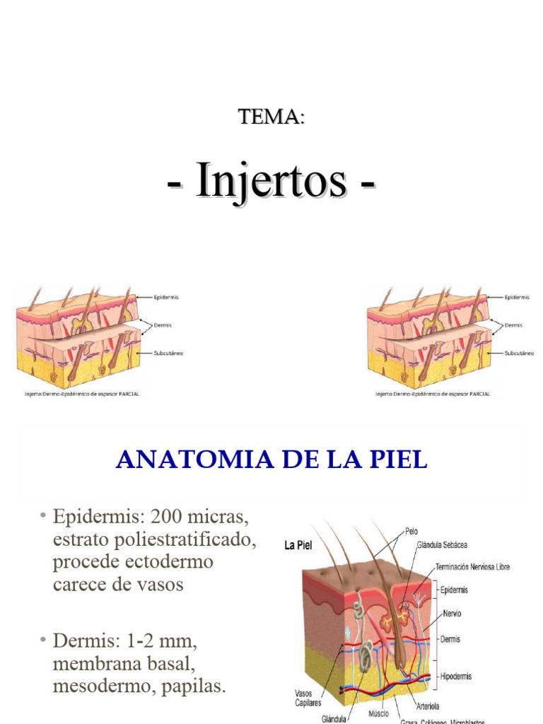 INJERTOS - PPT Estela y Yaneth | PDF | Piel | Anatomía