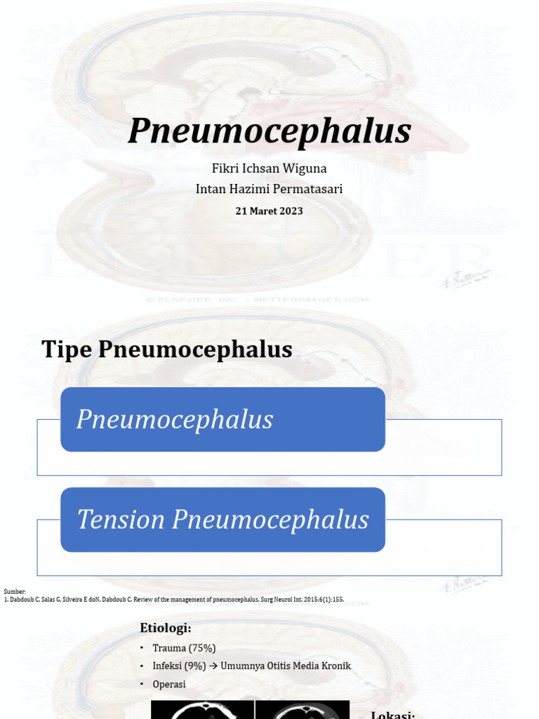 Pneumocephalus | PDF | Neurology | Nervous System