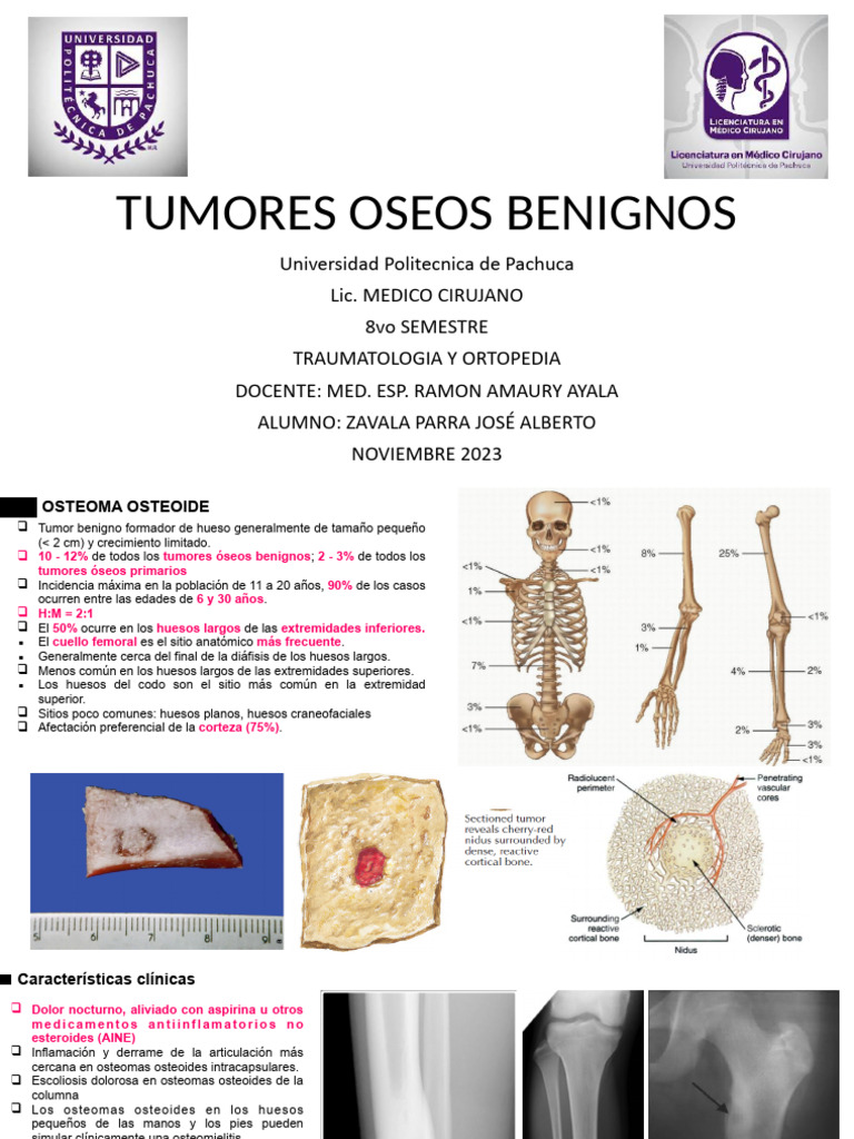 Tumores Oseos Benignos 2 | Descargar gratis PDF | Hueso | Especialidades Medicas