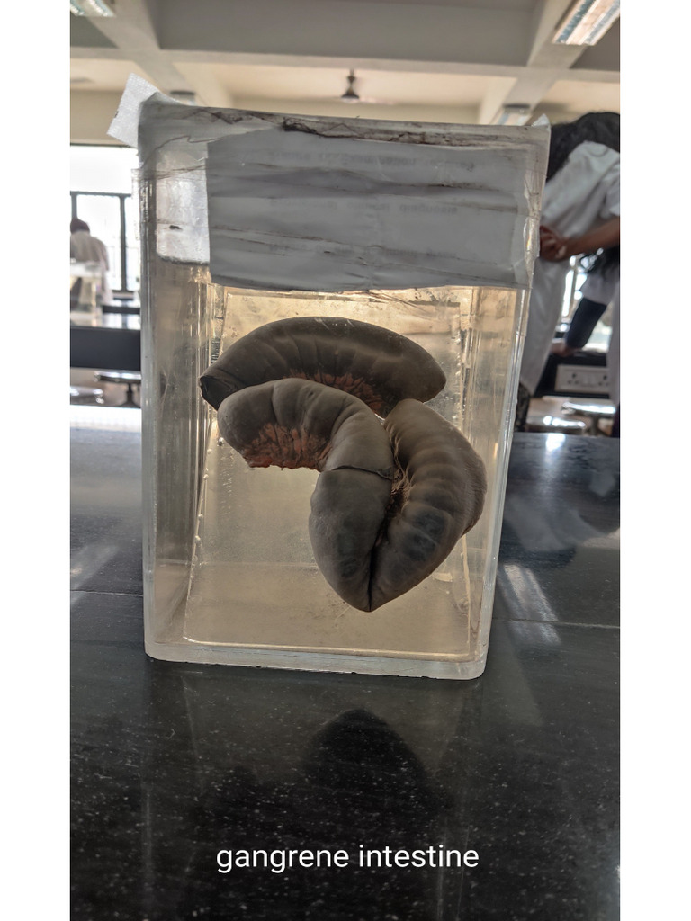 1.pathology Specimen | PDF