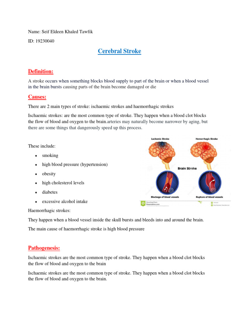 Cerebral Stroke | PDF