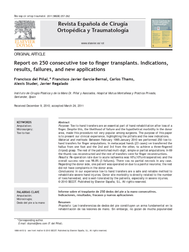 Report On 250 Consecutive Toe To Finger Transplants. Indications ...