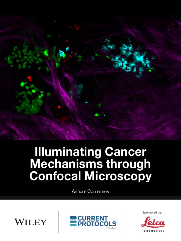 Article Collection Illuminating Cancer Mechanisms Through Confocal Micros | PDF | Amino Acid ...