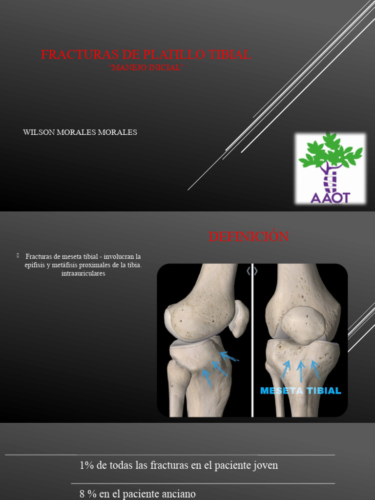 Manejo de Fracturas de Platillo Tibial | PDF | Epidemiología ...