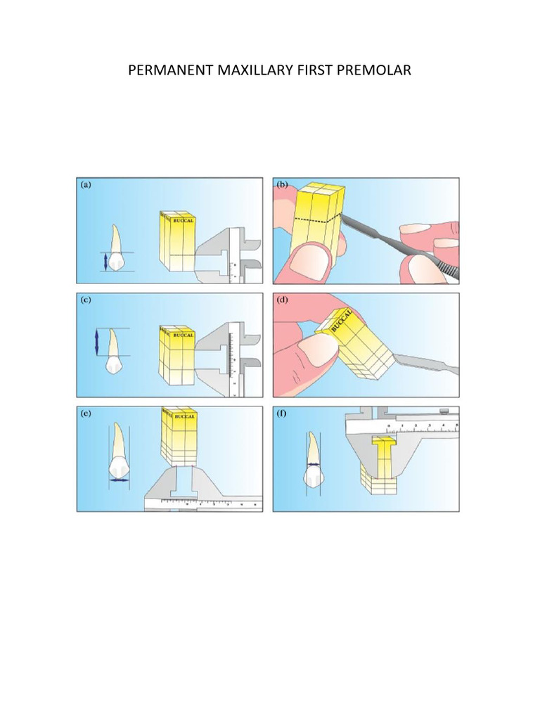 Carving of Permanent Maxillary First Premolar | PDF