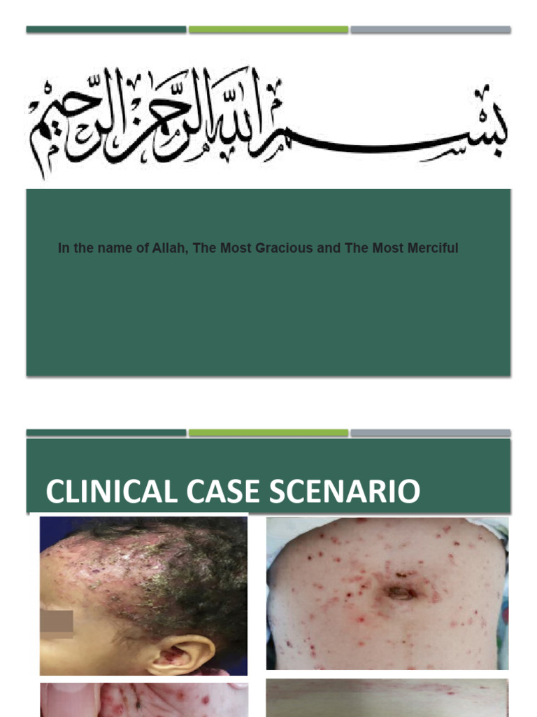 Pediatric LCH Diagnosis Guide | PDF | Self-Improvement