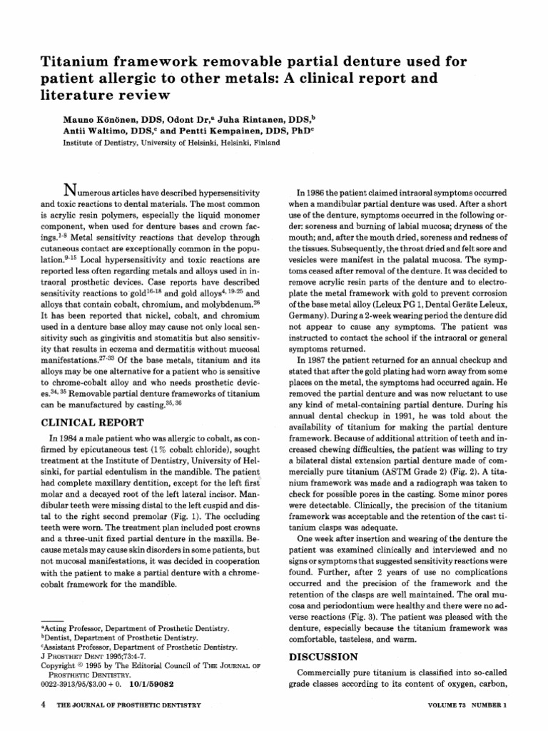 Titanium Framework Removable Partial Denture Used For | PDF | Dentures ...