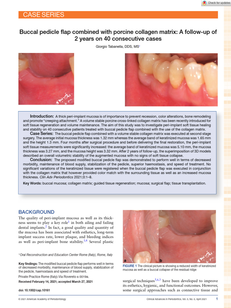 Buccal Pedicle Flap with Collagen Matrix: 2-Year Study | PDF | Dental ...