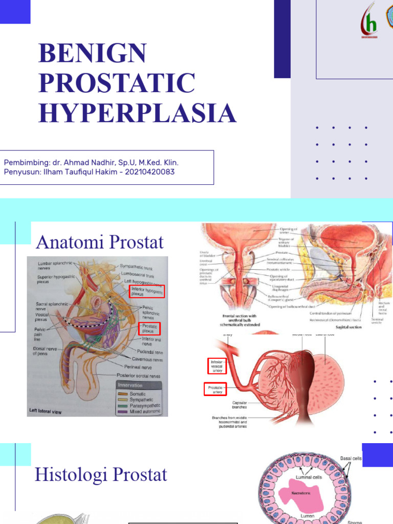 Benign Prostat Hiperplasia | PDF