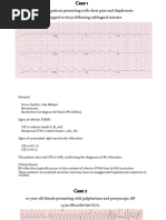 ECG EKG Examples and Quiz | PDF | Electrocardiography | Cardiac ...