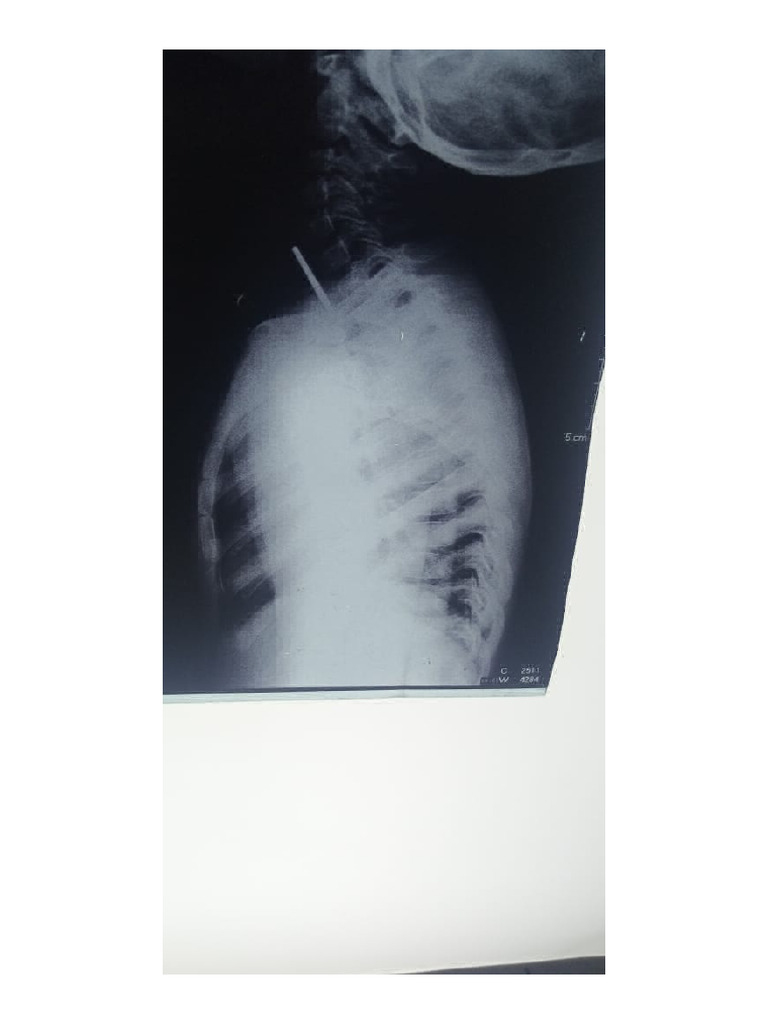 ENT X-Rays Q49 | PDF