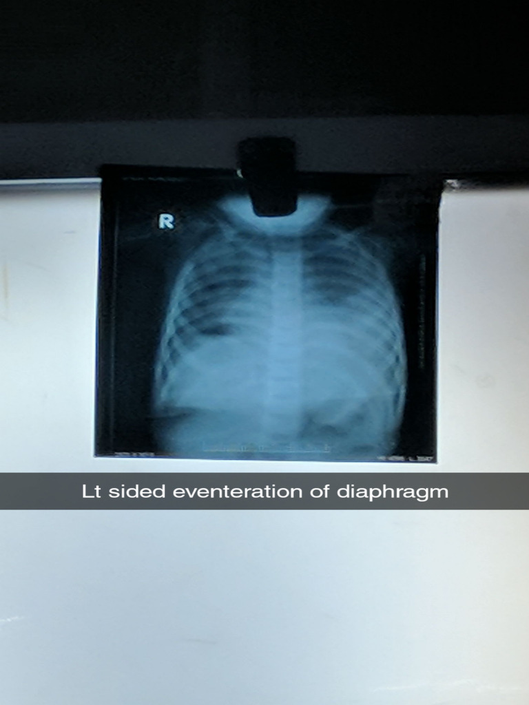 Paeds Xrays Revision | PDF