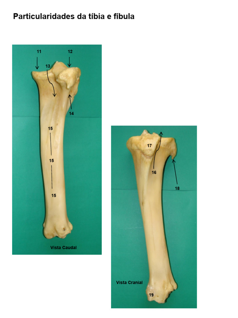 4-Estudo aplicado reconhecimento estruturas ósseas MP bovino tíbia ...