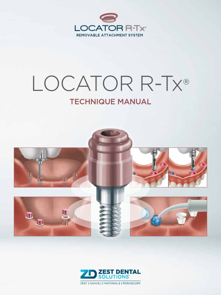 Za Removable Attachment L8024 Locator RTX Manual TM | PDF | Dentures ...