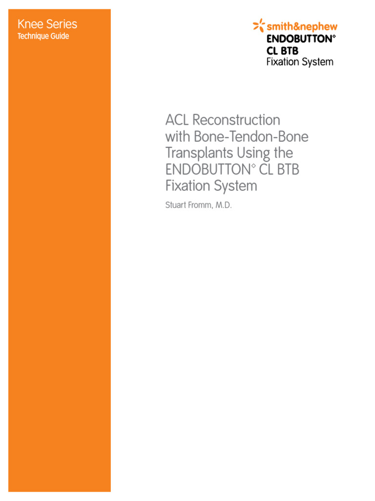 ACL BTB Using EndoB | PDF