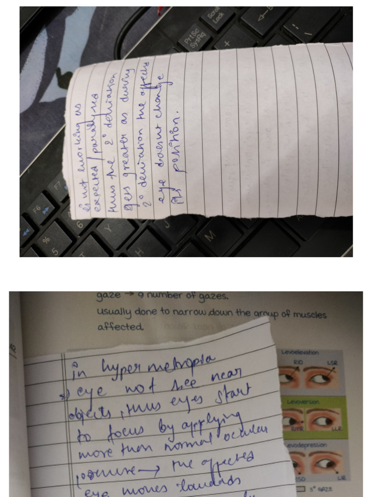 Baba Notes Squint | PDF