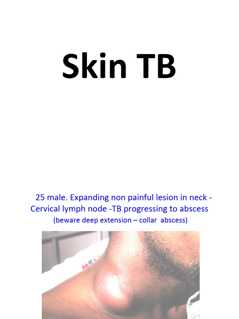 1.5. Skin TB | PDF | Science & Mathematics