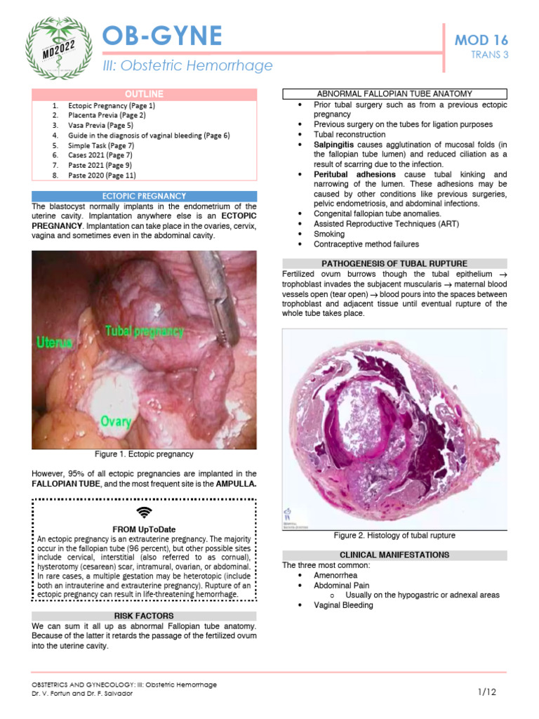 16.03 OBG Obstetric Hemorrhage | PDF | Childbirth | Pregnancy