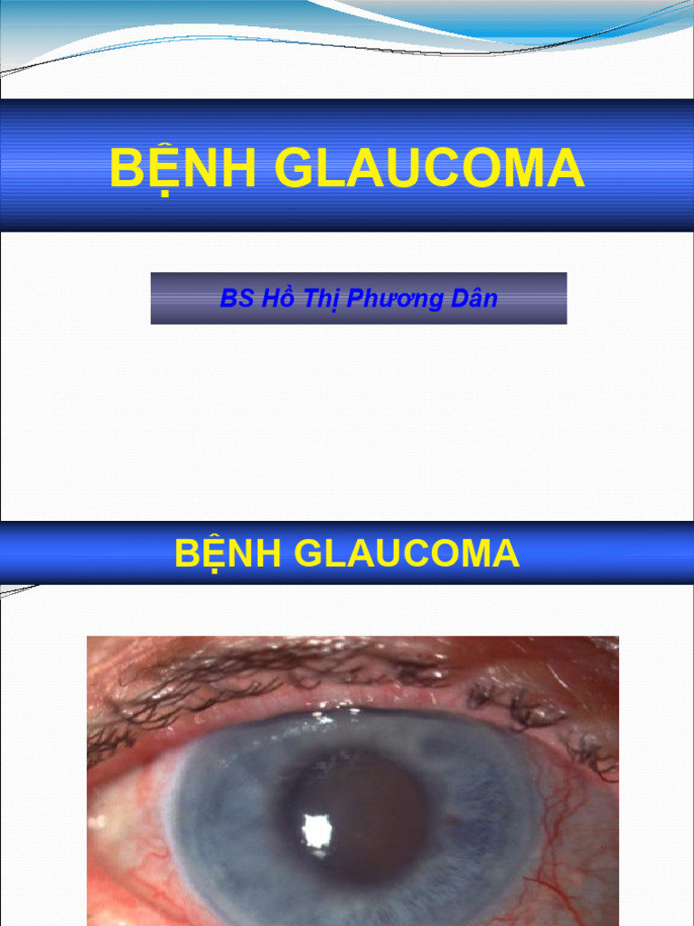 GLAUCOMA | PDF