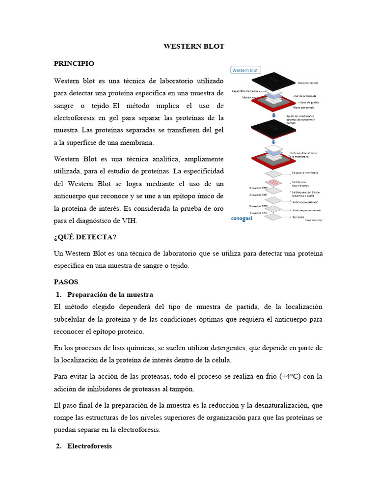 Western Blot | PDF