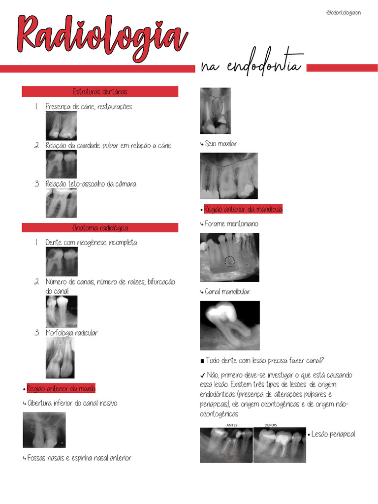 radiografias em endo | PDF