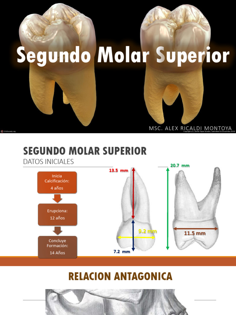 Tema19 Segundo Molar Superior | PDF