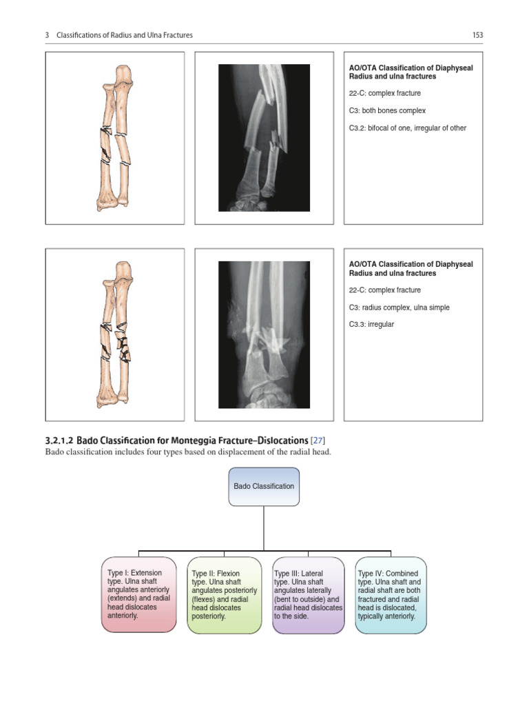 BC Clinical Classification 2018 - 3 - 2 - 1 - 2 - Bado Classification ...