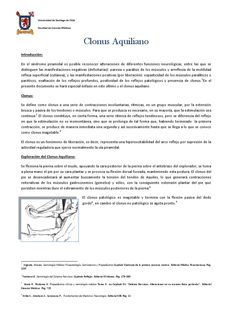 Clonus aquiliano(2)