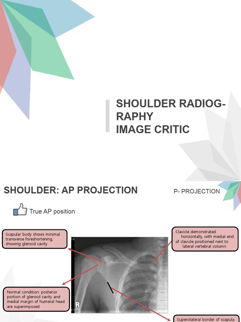 Shoulder Radiography Image Interpretation | PDF