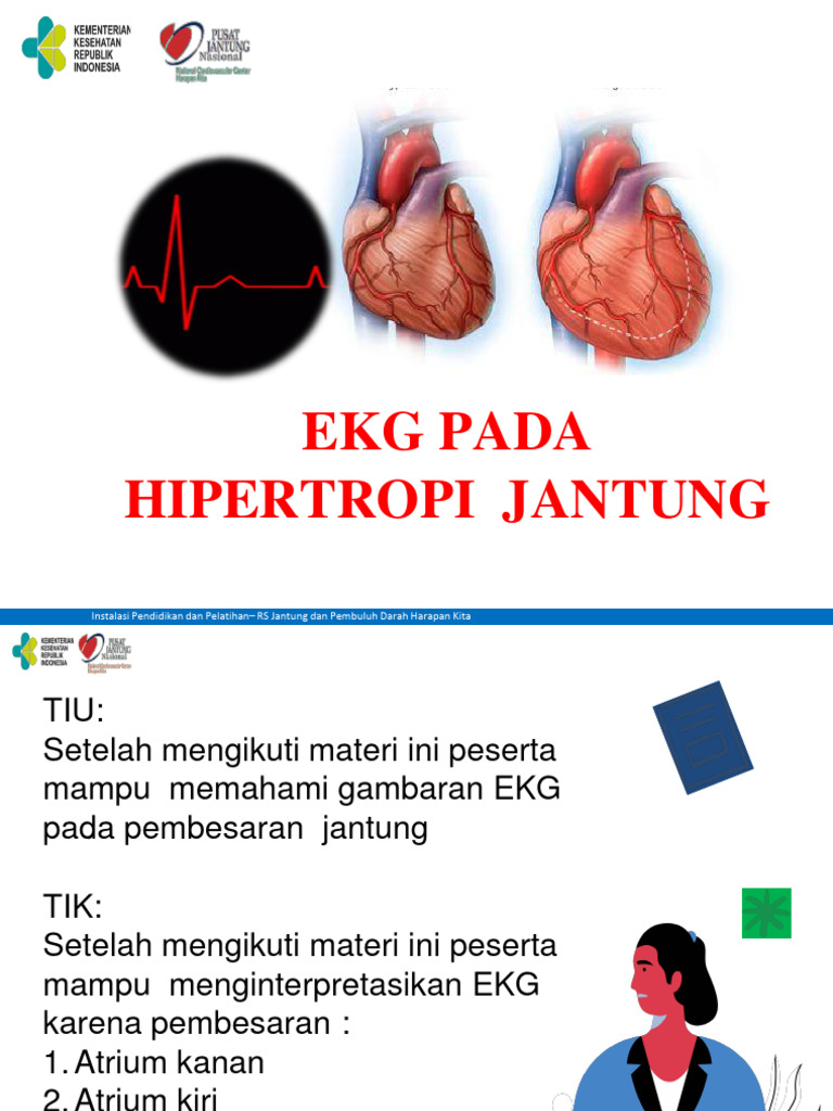 EKG untuk Diagnosa Hipertrofi Jantung | PDF | Sains & Matematika | Sejarah