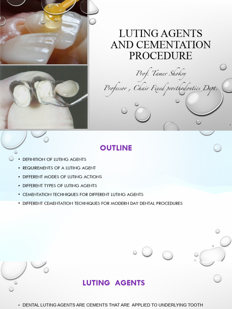 Luting Agents and Cementation Final 2 | PDF