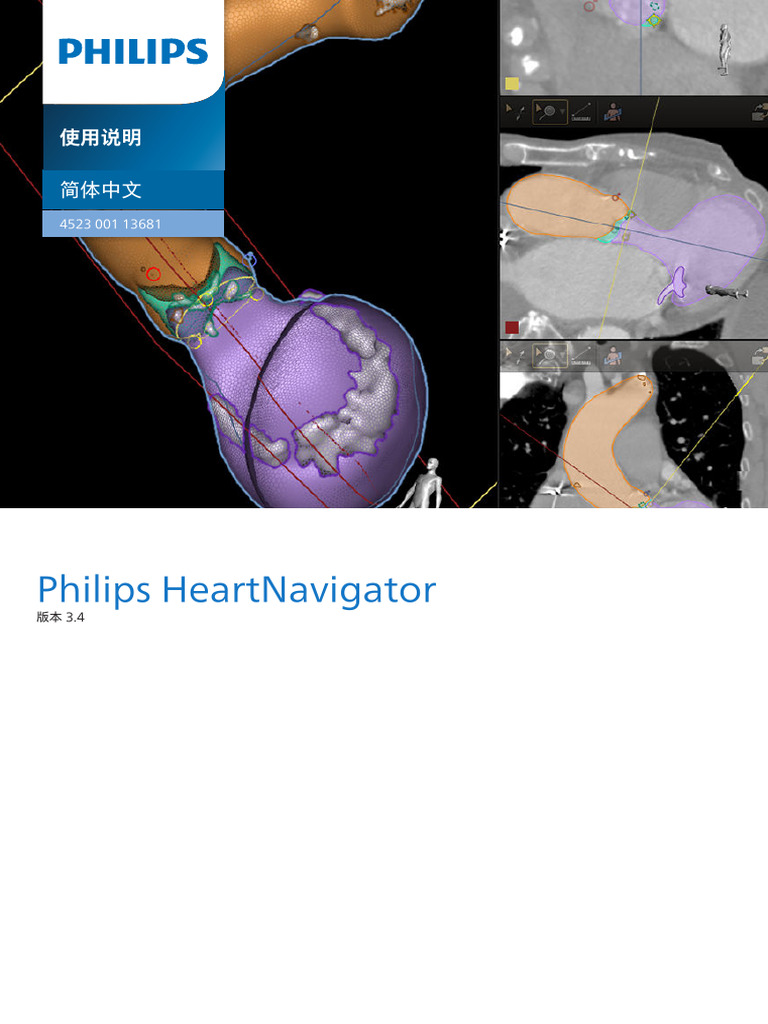 Philips HeartNavigator | PDF