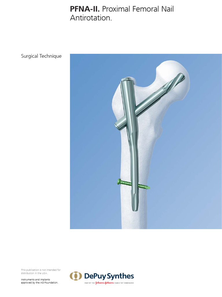 PFN A2 Implants and Technique | PDF | Drill | Electrical Connector