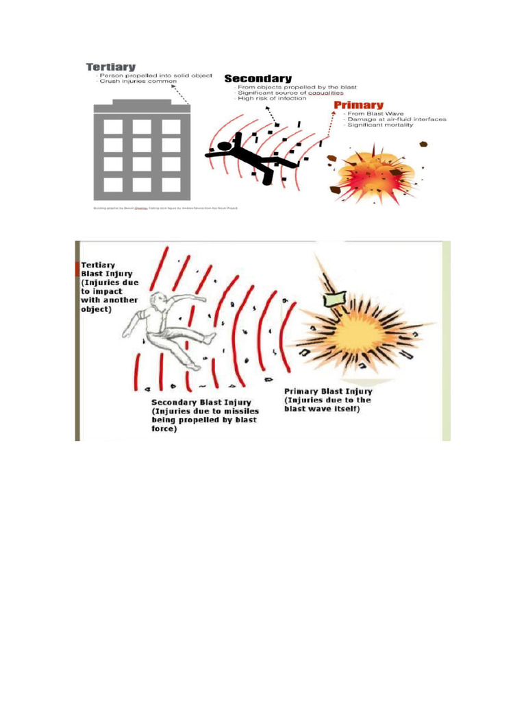 Lesoes Produzidas Por Agentes Explosivos | PDF