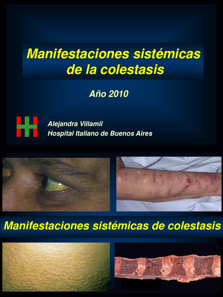 Colestasis: Manifestaciones y Complicaciones | PDF | Cirrosis | Sistema ...