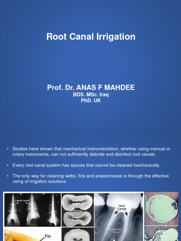 Effective Root Canal Irrigation Techniques | PDF | Home & Garden | Wellness