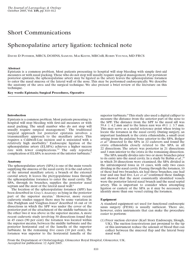 Sphenopalatine Artery Ligation Techniques | PDF | Human Nose | Clinical ...