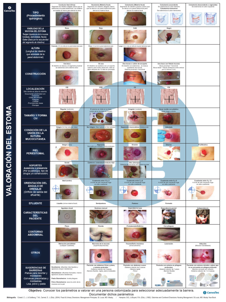 CVT Poster Valoración Estoma | PDF | Intestino grueso | Tracto ...