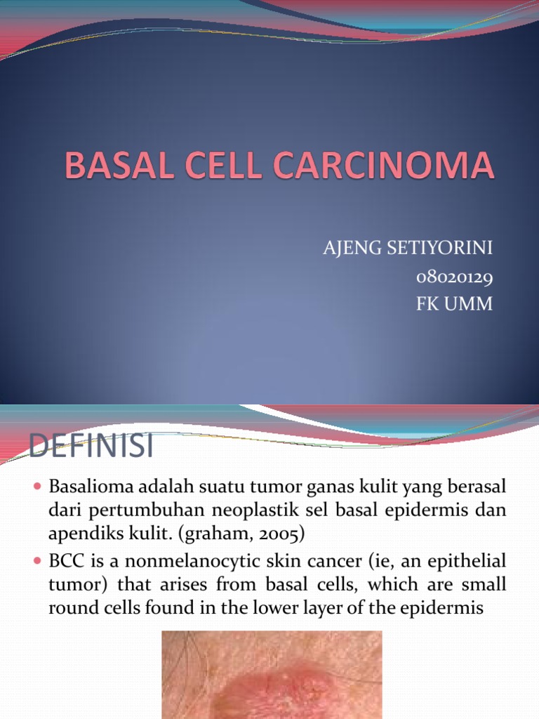 Basal Cell Carcinoma | PDF | Epitelium | Kanker