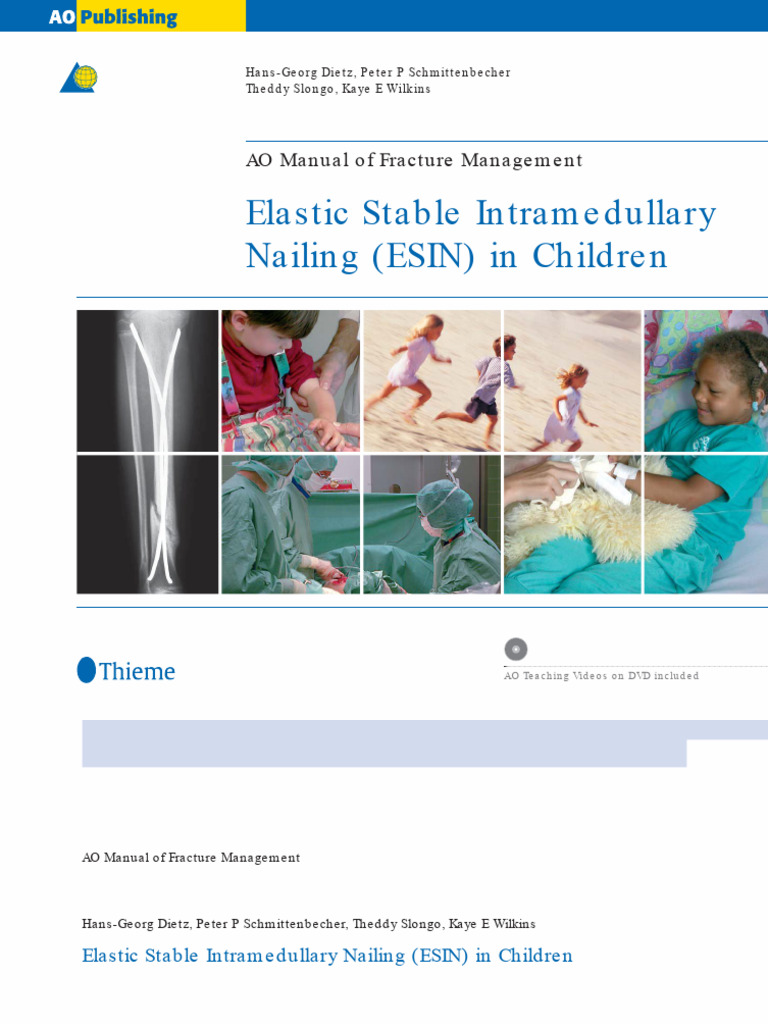 AOTrauma Elastic Stable Intramedullary | PDF