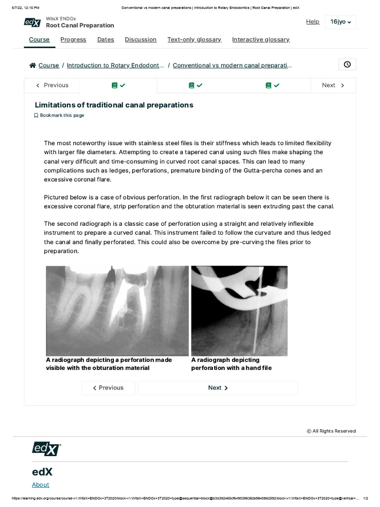Conventional Vs Modern Canal Preparations - Introduction To Rotary Endodontics - Root Canal ...