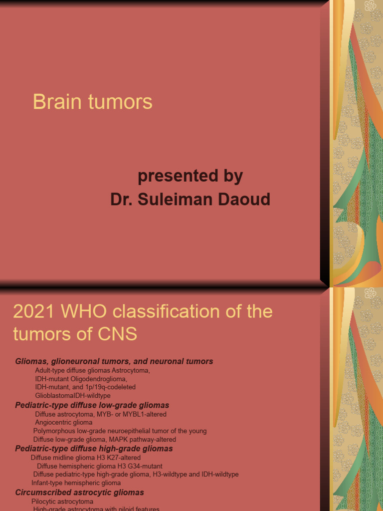 Brain Tumors | PDF