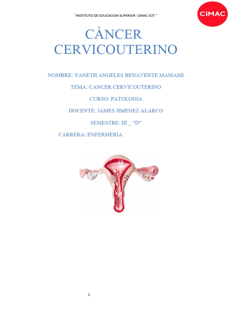 Càncer Cervicouterino | PDF | Cáncer de cuello uterino | Cáncer