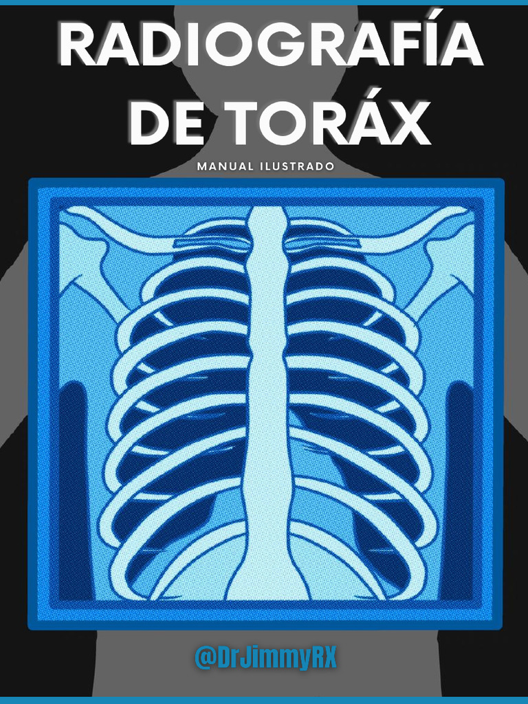 Manual RX de Torax | PDF | Pulmón | Tórax (anatomía humana)