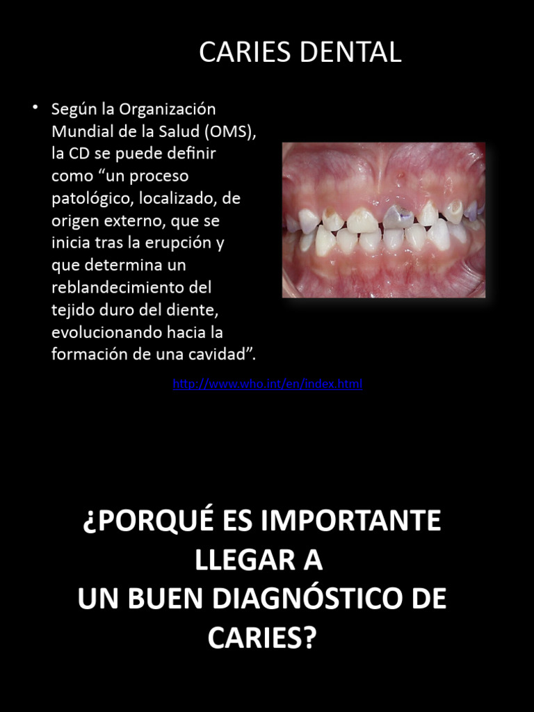 Caries 2 | PDF | Esmalte de dientes | Diente