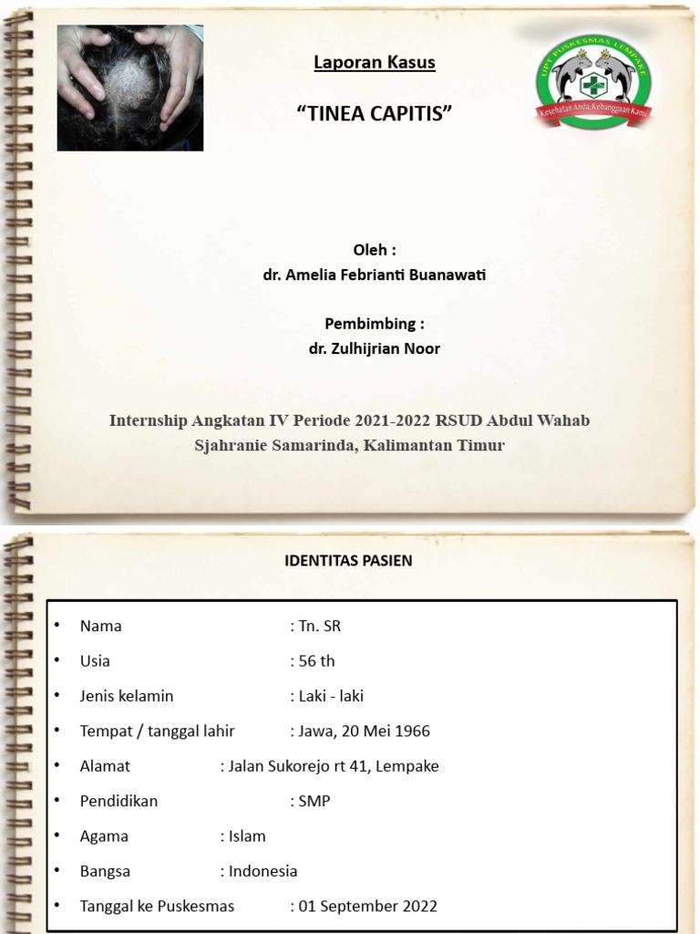 Tinea Capitis: Kasus dan Penanganan | PDF