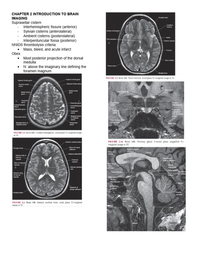 Chapter 2 Introduction To Brain Imaging | PDF | Magnetic Resonance ...