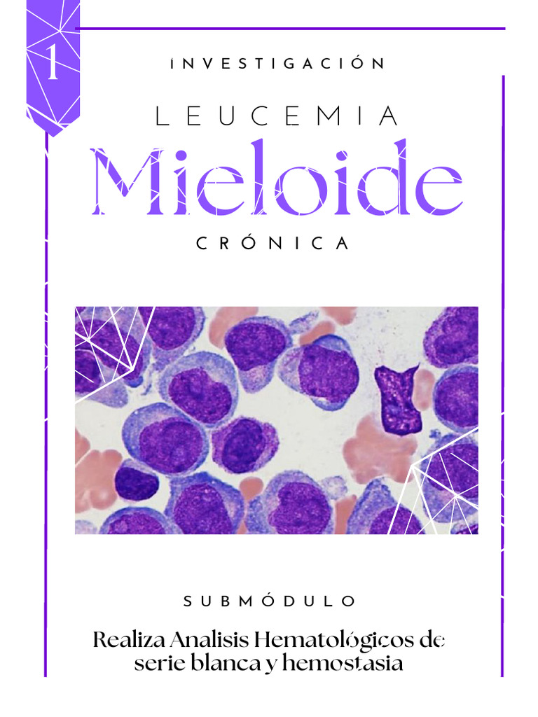 Leucemia Mielocítica Cronica | PDF | Leucemia | Sangre