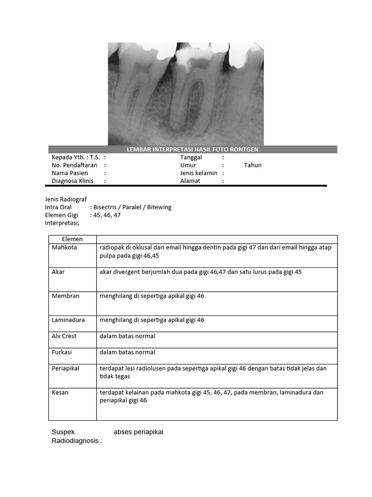 Interpretasi Hasil Foto Rontgen Gigi | PDF